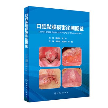 口腔黏膜损害诊断图鉴(精)