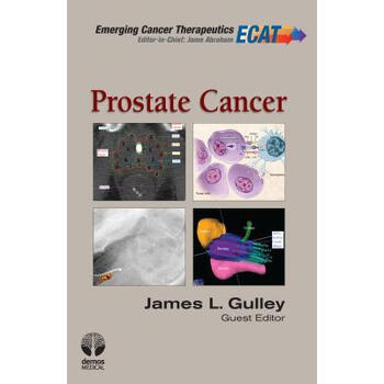 高被引Prostate Cancer