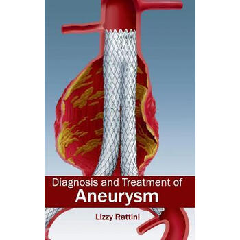 Diagnosis and Treatment of Aneurysm