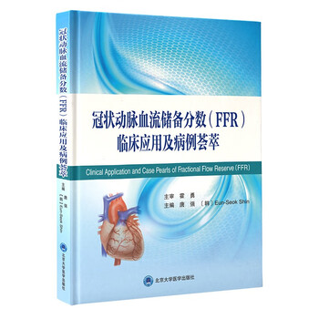 冠状动脉血流储备分数（FFR）临床应用及病例荟萃
