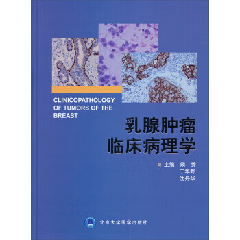 乳腺肿瘤临床病理学【正版图书】
