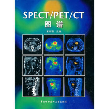 SPECTPETCT图谱