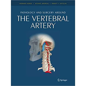 Pathology and Surgery Around the Vertebral Arter