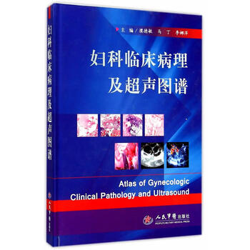 妇科临床病理及超声图谱
