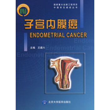 子宫内膜癌(中国常见癌症丛书)