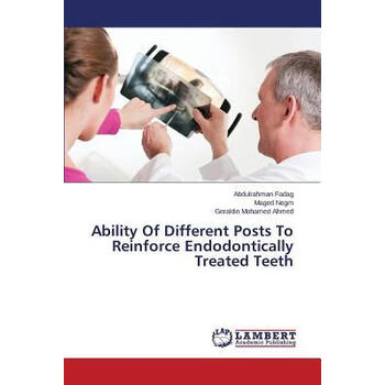 Ability of Different Posts to Reinforce Endodont
