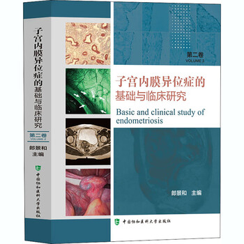 子宫内膜异位症的基础与临床研究 第2卷