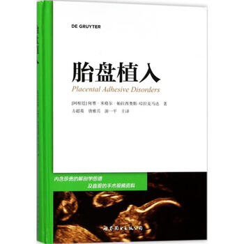 胎盘植入 世界图书出版公司 