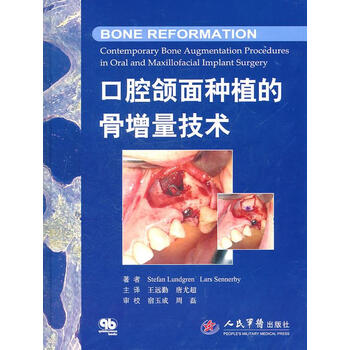 口腔颌面种植的骨增量技术【正版图书】