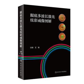 眼底多波长激光炫彩成像图解【正版图书】