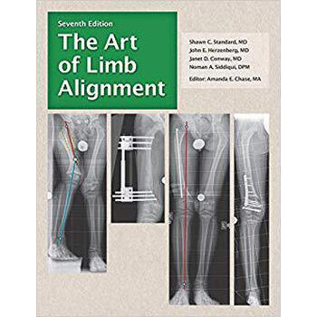 【】The Art of Limb Alignment