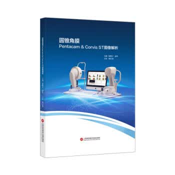 圆锥角膜Pentacam&Corvis ST图像解析