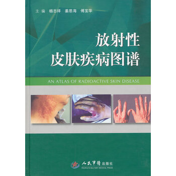 放射性皮肤疾病图谱 杨志祥 人民军医出版社