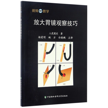 放大胃镜观察技巧