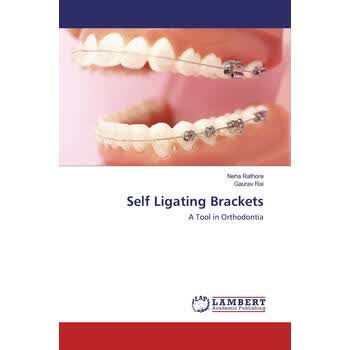 Self Ligating Brackets