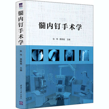 髓内钉手术学