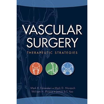 Vascular Surgery: Therapeutic Strategies