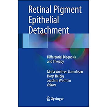 Retinal Pigment Epithelial Detachment: Different
