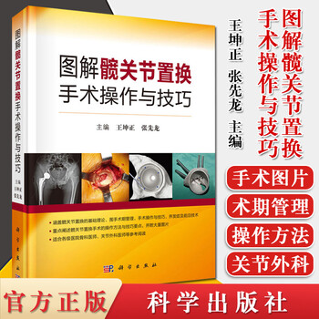 图解髋关节置换手术操作与技巧  王坤正 张先龙主编 髋关节基础理论手术技巧 临床医学 科学出版社