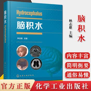 脑积水 林志雄 主编 显微外科神经内镜神经外科学脑血管脑外科颅脑损伤书籍手术 化学工业出版社