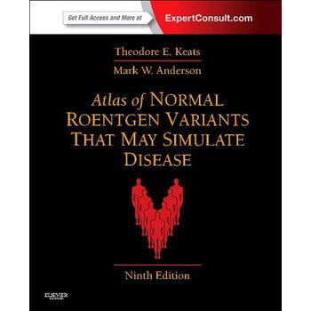 Atlas of Normal Roentgen Variants That May Simul