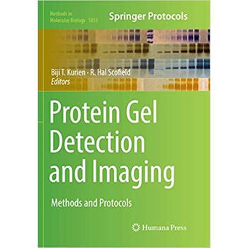 Protein Gel Detection and Imaging: Methods and P