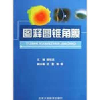 图释圆锥角膜