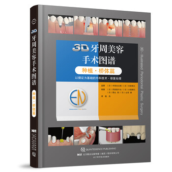 3D牙周美容手术图谱：种植·桥体篇