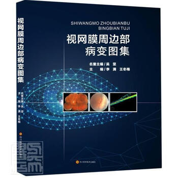 正版当日发货 视网膜周边部病变图集普通大众视网膜疾病图集医学者_李满王冬梅责_吴晓琳四川科学技术出版