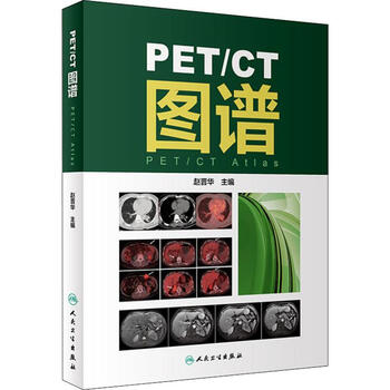 PET/CT图谱 赵晋华 编 书籍