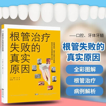 根管治疗失败的真实原因 口腔科学临床治疗