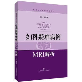 妇科疑难病例MRI解析