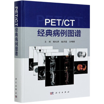 PET\CT经典病例图谱(精)