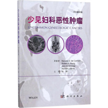 少见妇科恶性肿瘤(中文翻译版)