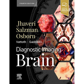 Diagnostic Imaging: Brain 诊断成像：大脑