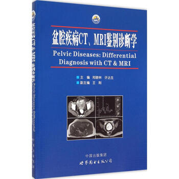 盆腔疾病CT、MRI鉴别诊断学