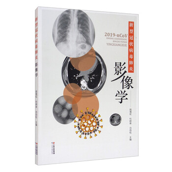 新型冠状病毒肺炎影像学