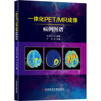一体化PET/MR成像病例图谱 卢洁 编 书籍