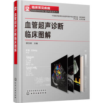 血管超声诊断临床图解 穆玉明 编 书籍