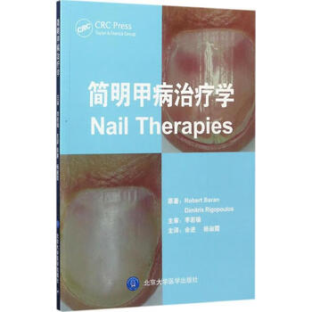 简明甲病治疗学 北京大学医学出版社 