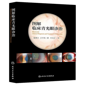 图解临床青光眼诊治【正版图书】