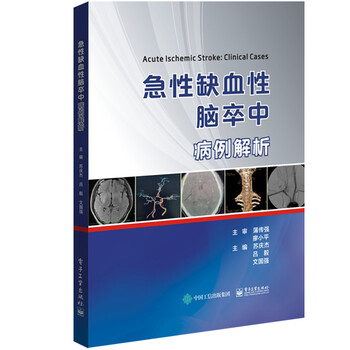 急性缺血性脑卒中病例解析 苏庆杰  书籍
