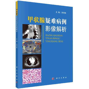 甲状腺疑难病例影像解析