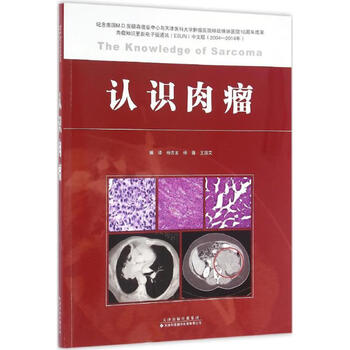 认识肉瘤