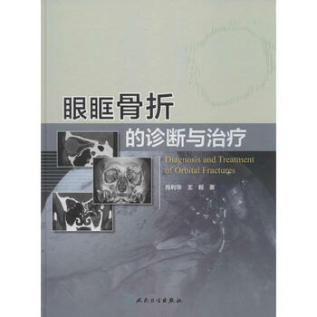 眼眶骨折的诊断与治疗