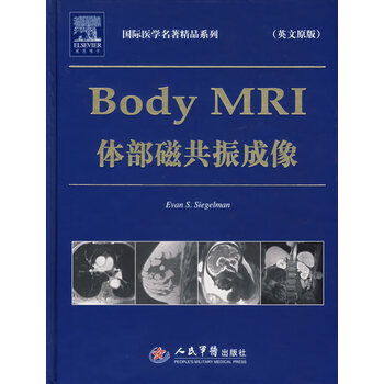 体部磁共振成像.国际医学名著精品.英文版