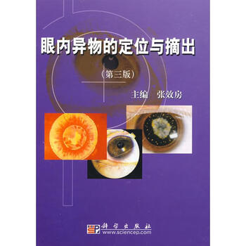 眼内异物的定位与摘出(第三版)