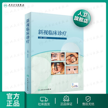斜视临床诊疗