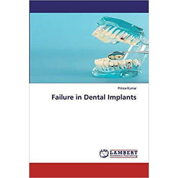 Failure in Dental Implants