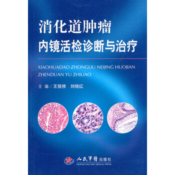 消化道肿瘤内镜活检诊断与治疗